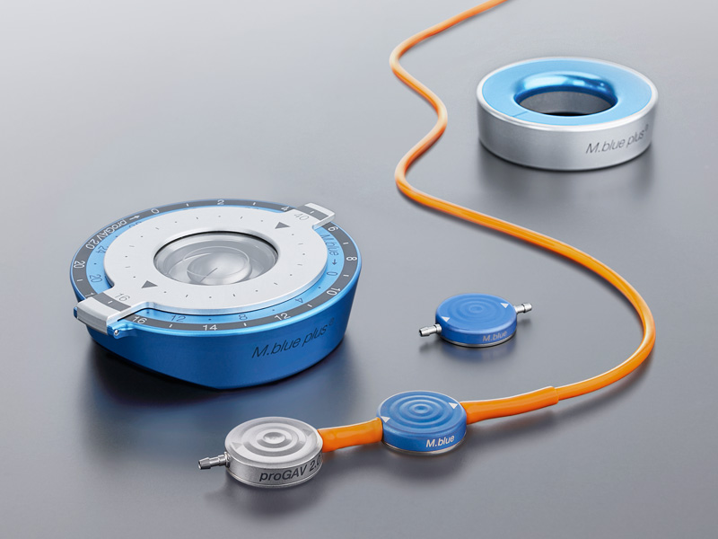 MIETHKE M.blue® – Adjustable gravitational valve for the treatment of ...
