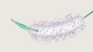 SeQuent® DCBs – Coronary Drug Coated Balloons