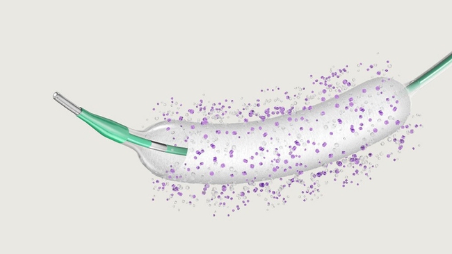 SeQuent® DCBs – Coronary Drug Coated Balloons - B. Braun