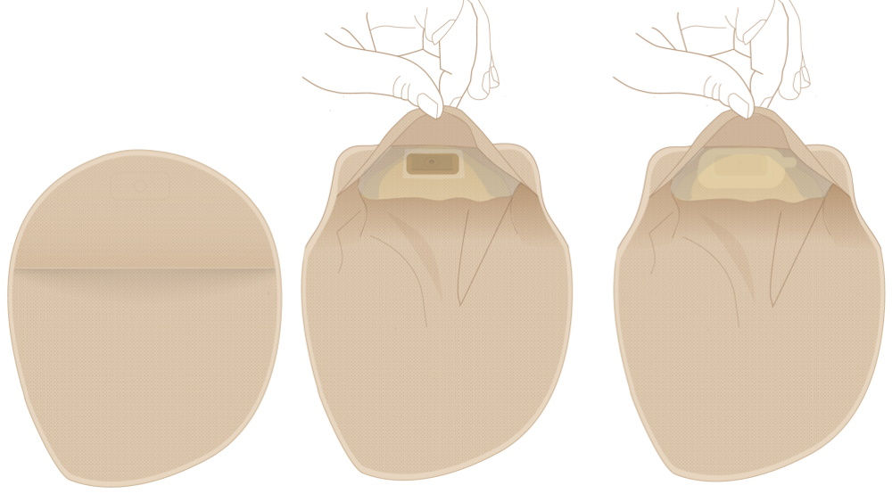 Swimming with Stoma: The Right Ostomy Swimwear - B. Braun