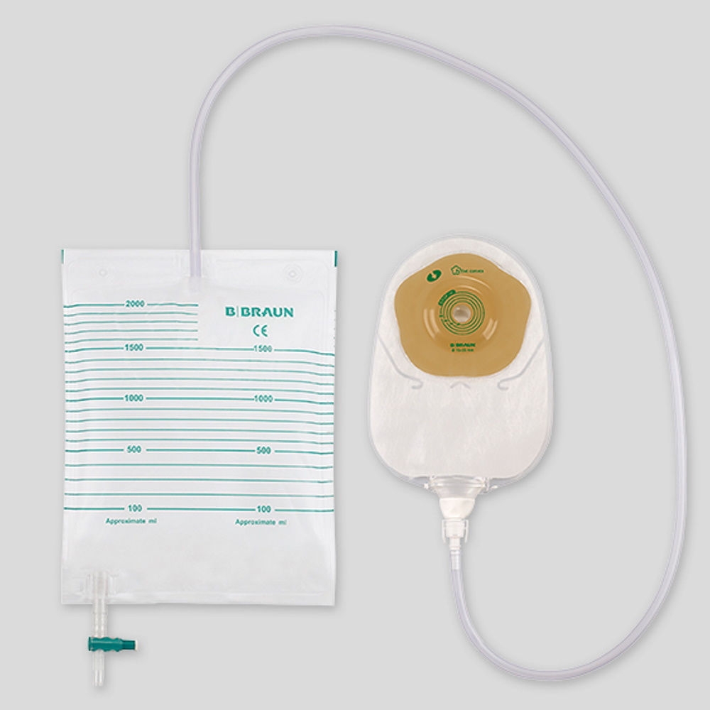 Urostomy Bags and Solutions: Advantages and Tips