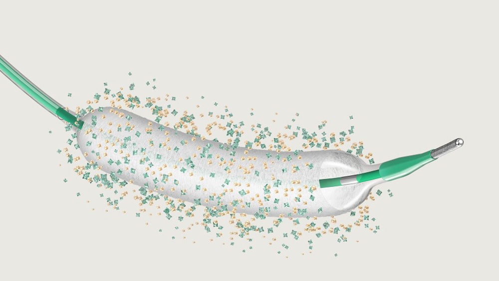 SeQuent® DCBs – Coronary Drug Coated Balloons - B. Braun
