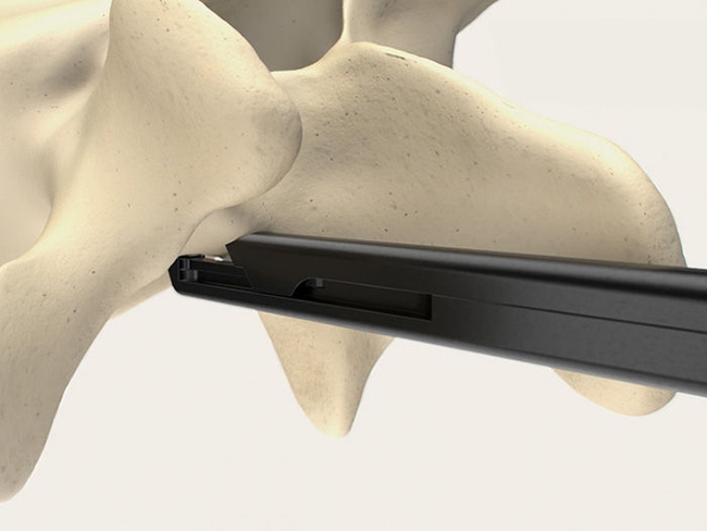 SQ.line® KERRISON Bone Punch - B. Braun