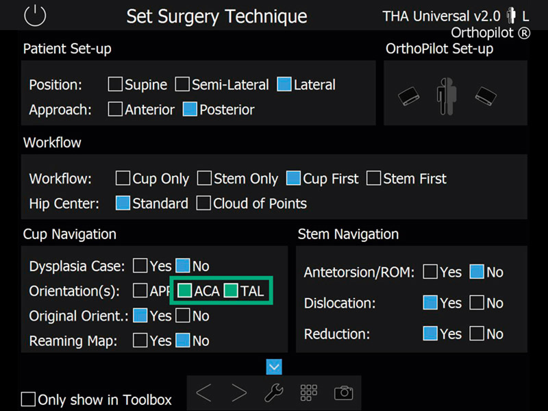THA ACA navigation software hip arthroplasty - B. Braun