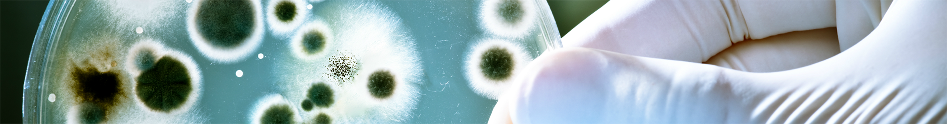 Microbiological Contamination microbiological-contamination