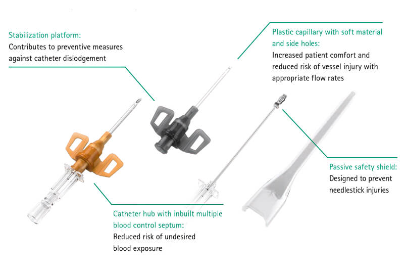 Diacan® Flex: AV Fistula Catheter for Hemodialysis and Apheresis