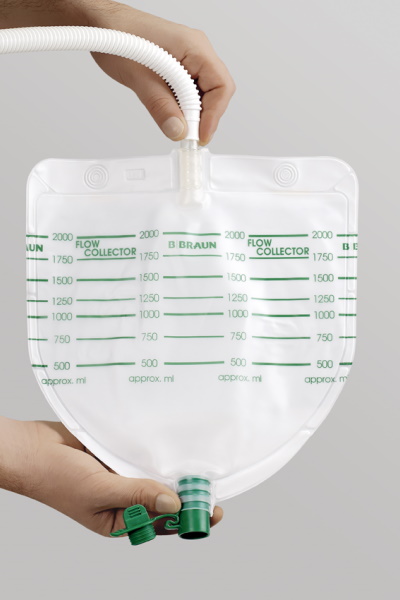 High-output stoma management