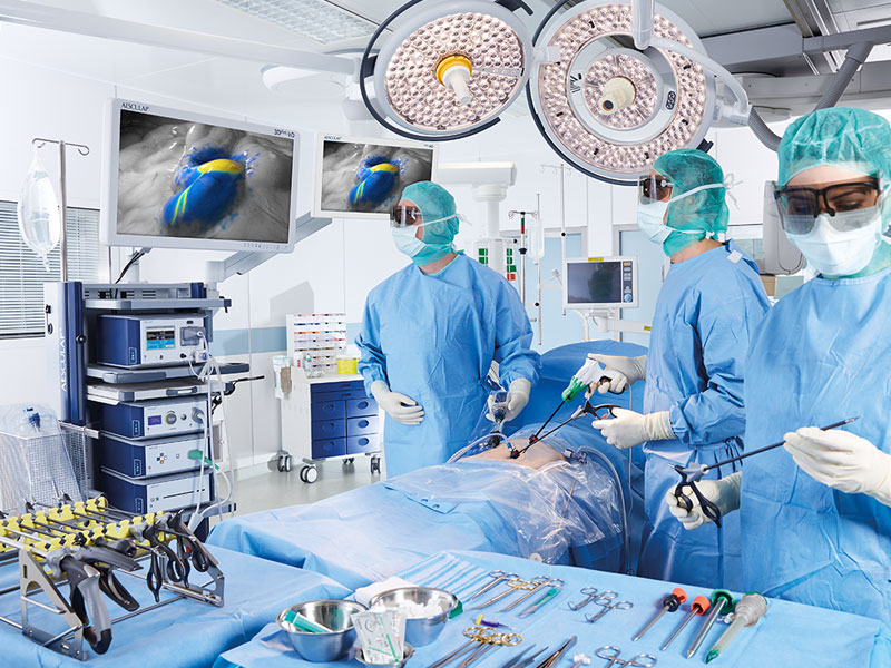 Hemicolectomy