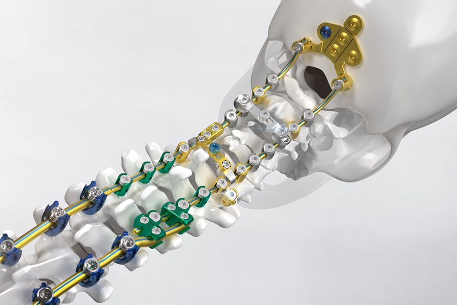 Ennovate® Cervical